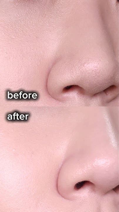 환절기 스킨케어 조합 피부진정 화잘먹피부 가능 Shorts Youtube