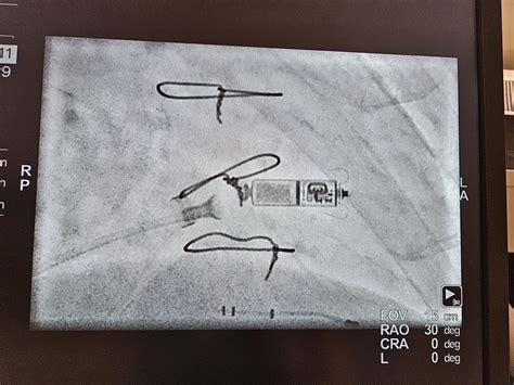 Hull University Teaching Hospitals Nhs Trust Page 2