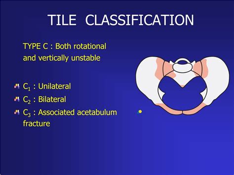 Ppt Expert Insights On Pelvis And Acetabulum Fractures Treatment Powerpoint Presentation Id Ppt Expert Insights On Pelvis And Acetabulum Fractures Treatment Powerpoint Presentation Id