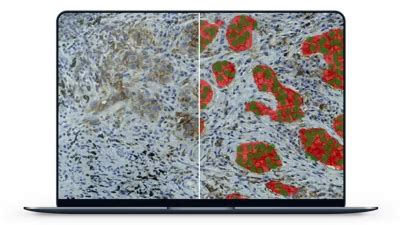 How To Annotate Patent Webpages For Enhanced Research