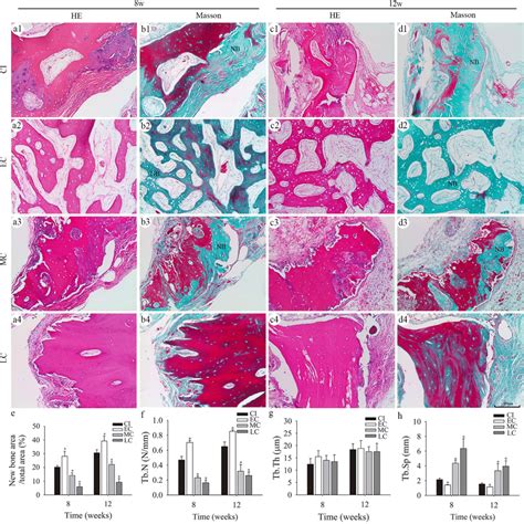 New Bone Formation Induced By Bone Callus In Nude Mice As Assessed By