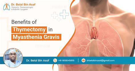 Thymectomy Post Op Complications Dr Belal Bin Asaf