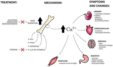 Hypercalcemia In Cancer Causes Effects And Treatment Strategies