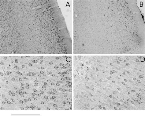 Effects Of Antisense Odn Treatment On Expression Of The Nmdar1 Subunit