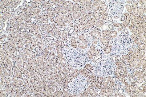 Foxo1 Antibody 18592 1 Ap Proteintech