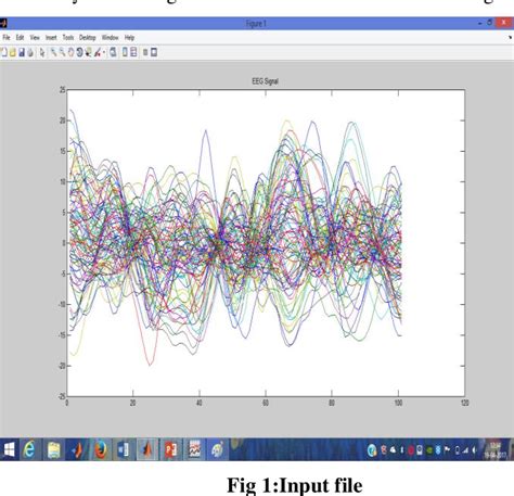 Figure 1 From Electroencephalography Eeg Signal Enhancement And