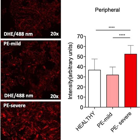 Assessment Of Placental Oxidative Stress Dhe Staining In Peripheral