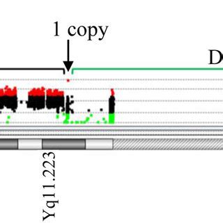 Array Comparative Genomic Hybridization Analysis Of The Patient Download Scientific Diagram