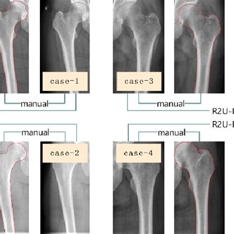 model segmentation effect diagram download scientific diagram