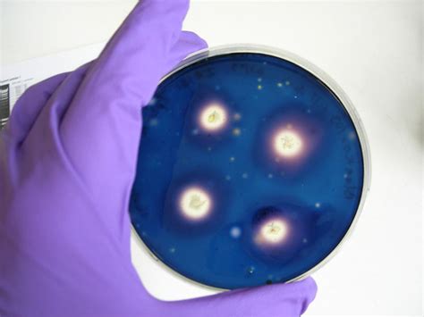 Teamcambridgebacillus Subtilis Transformation