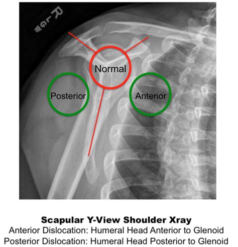 Y View X Ray Labeled At Nora Weeks Blog