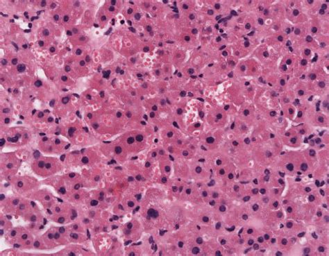 Urogenitaltrakt | el-IPH · Bildergalerien