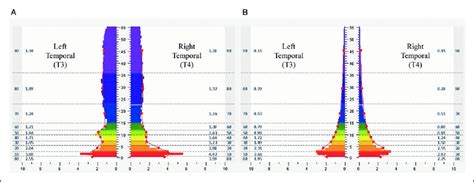 Fft Spectral Displays From A 40 Year Old Male Participant As An