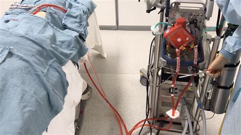 Ecmo Circuit