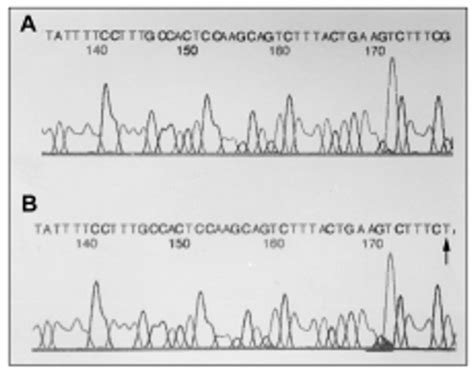 28 Sanger Sequencing Biology Libretexts