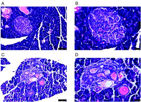The Hande Staining Of Pancreas In Ab Normal And Cd Model Groups