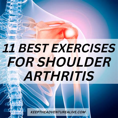 Physical Therapy Exercises For Arthritis In Shoulder At Lea Blackburn Blog