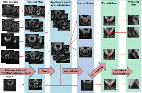 Figure 1 From An Automatic Multi Atlas Based Prostate Segmentation