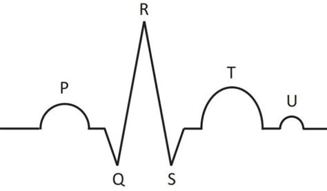 Ml Assisted Ecgekg Anomaly Detection Using Lstm Autoencoder Digital