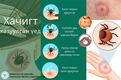 Хачигт Өвөрхангай аймаг Зоонозын Өвчин Судлалын Төв Facebook