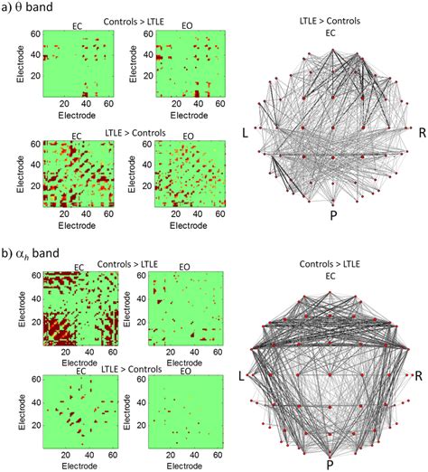 Connectivity Matrices Showing Synchronization Between Each Pair Of