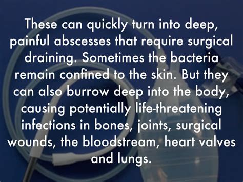 Staphylococcus Aureus Mrsa By Monet Chisholm