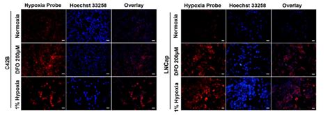 Figure S8 Hypoxia Validation In C4 2b And Lncap Prostate Cancer Cells