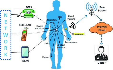 The Implantable Medical Devices Schematic Diagram Imds 3 Download Scientific Diagram