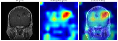 gradcam enhancing neural network interpretability