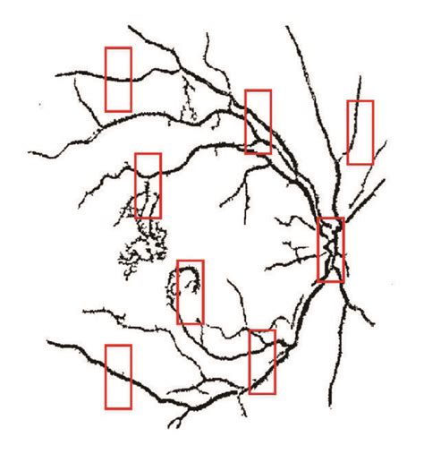 Illustration Of The Process For Localizing The Center Of The Optic Download Scientific Diagram