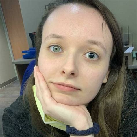 Unusual Genetic Anomalies 21 Pics