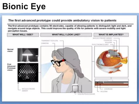 brain computer interfaces bci pptx