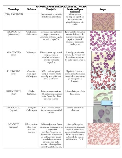 Anomalías Eritrocitos