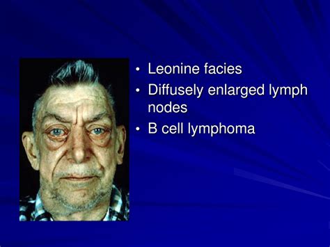 Ppt General Appearance Powerpoint Presentation Free Download Id
