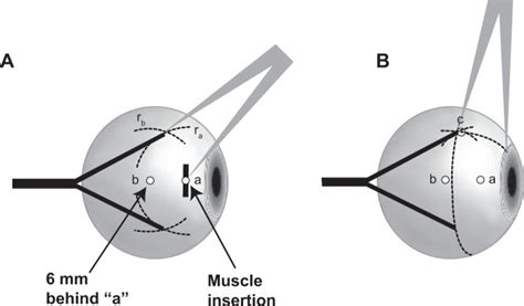 Y Split Recession Side View Notes A The First Orientation Point
