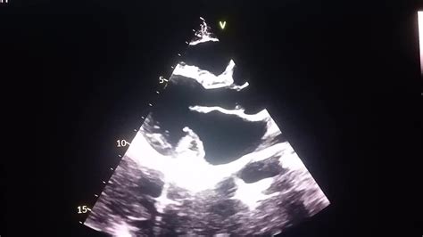 Lakshmi Prasad On Linkedin Dx