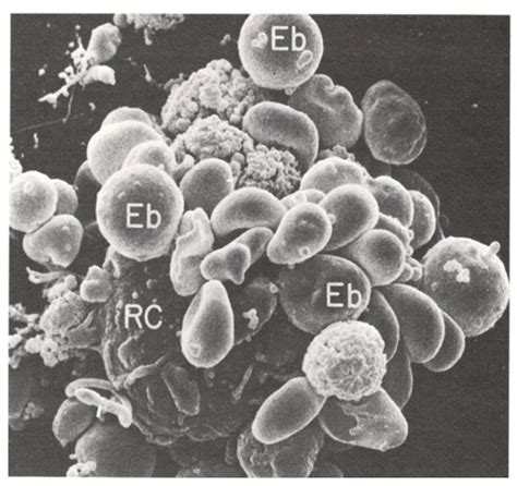 Eritropoiesi
