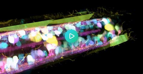 Neuron Growth Album On Imgur