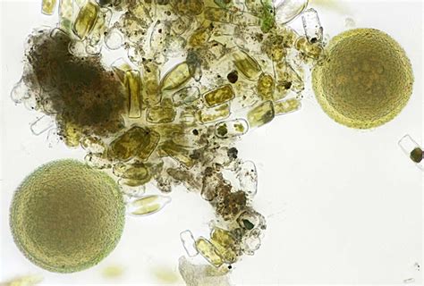 Alan Woods Microscopical Diary 2017