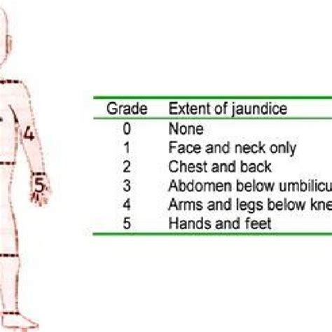 Visual Assessment Scale Of Neonatal Jaundice [36 37] Download