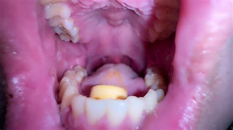 Swallowing Tablet ThisVid Com