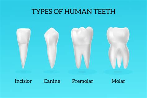 Teeth Braces Types Realistic Infographics Vector Image