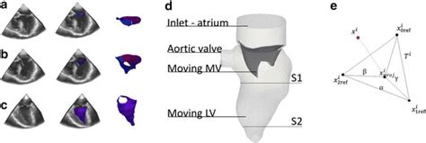 From Rt Tee Ultrasound Images To Segmented Triangulated Surfaces A Mv Download Scientific