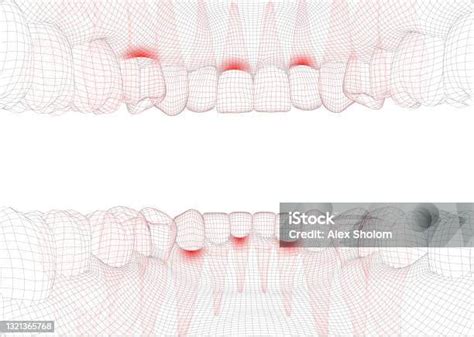 인간의 턱 3d 벡터 레이아웃 의학 및 건강 통증 치아 3차원 형태에 대한 스톡 벡터 아트 및 기타 이미지 3차원 형태 개선 개체 그룹 Istock