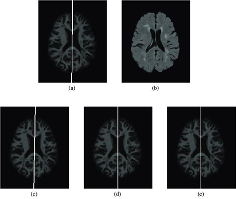 Comparison Between Msp Detection Techniques On An Image With An Average