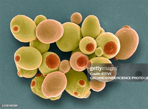 Environmental Scanning Electron Micrograph Photos And Premium High Res Pictures Getty Images