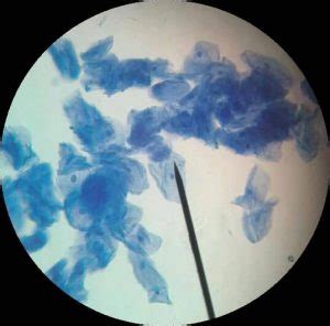 Cheek Cells 400x