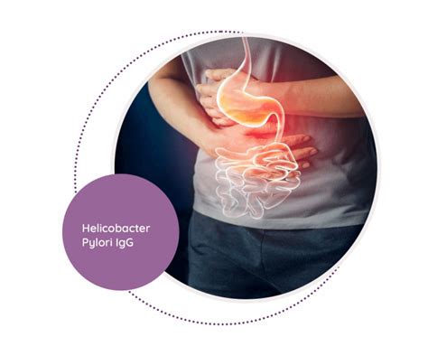 Helicobacter Pylori Igg Mediscan Lab