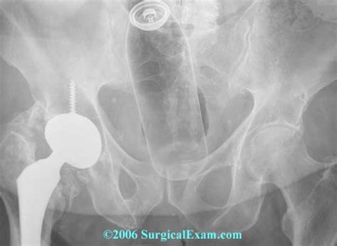 Surgical Exam