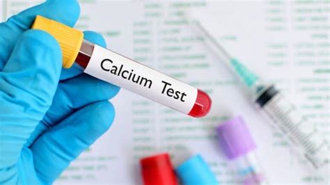 Calcium Lab Values Understanding The Results